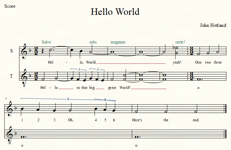 Triplets in 3/2 time in MusicXML 4.0 imported to PrintMusic – Finale ...